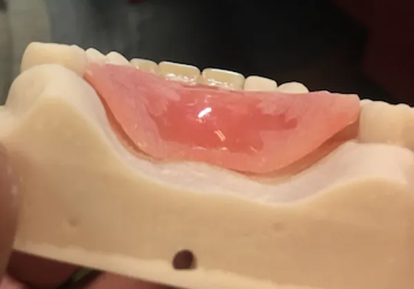 Denture Bases - Troubleshooting