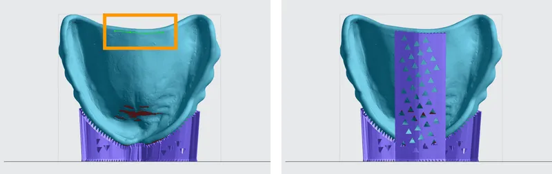 Lucitone Digital Print 3D Denture Base - Materials