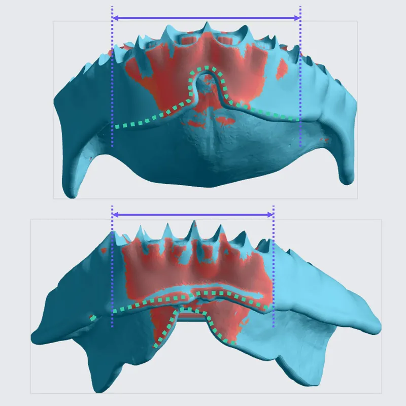 Lucitone Digital Print 3D Denture Base - Materials