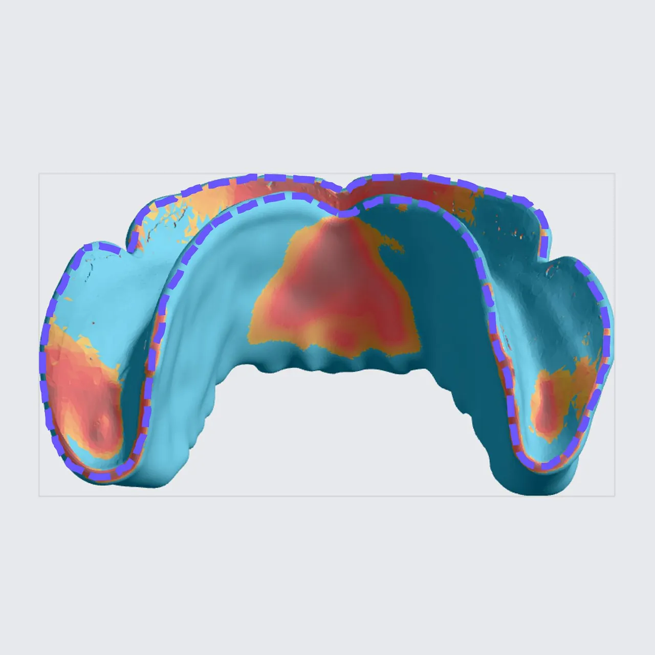 Lucitone Digital Print 3D Denture Base - Materials
