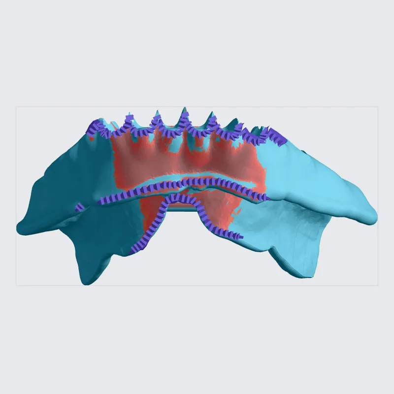 Lucitone Digital Print 3D Denture Base - Materials