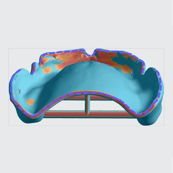 Lucitone Digital Print 3D Denture Base - Materials