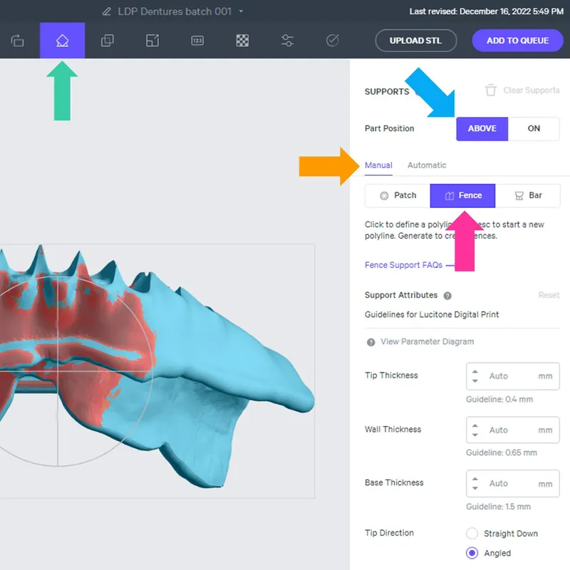 Lucitone Digital Print 3D Denture Base - Materials