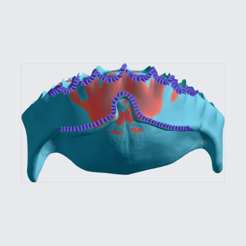 Lucitone Digital Print 3D Denture Base - Materials
