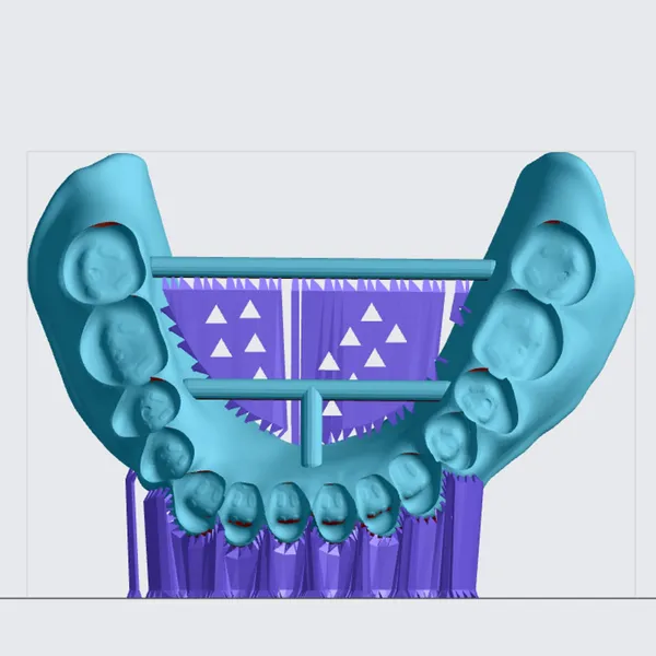 Lucitone Digital Print 3D Denture Base - Materials