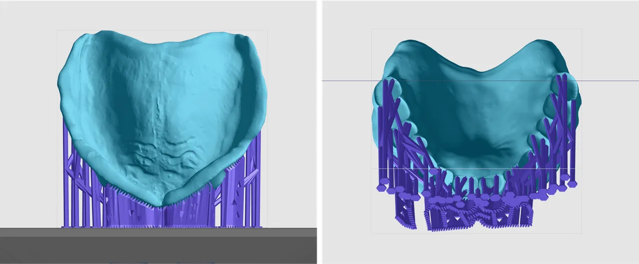 DENTCA Denture Base II for Carbon Printers - Materials