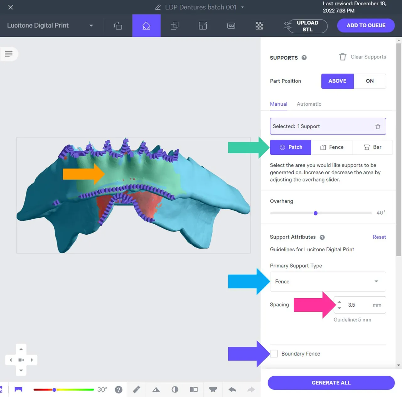 Lucitone Digital Print 3D Denture Base - Materials