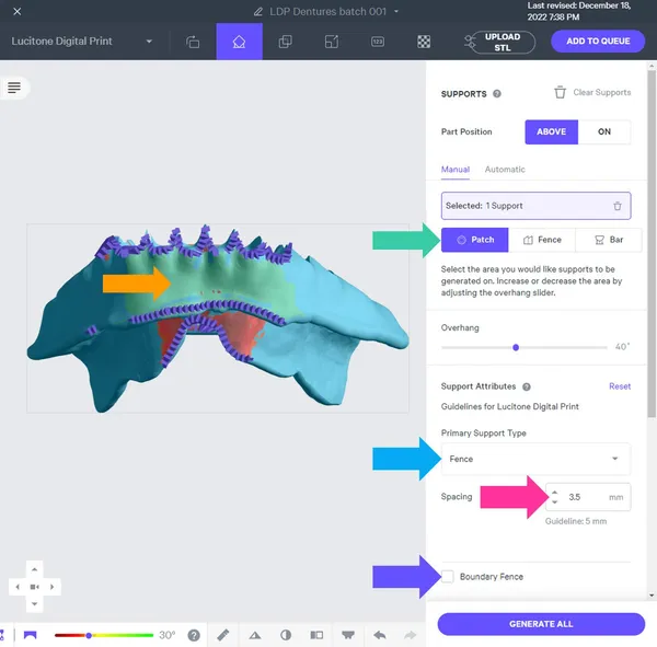 Lucitone Digital Print 3D Denture Base - Materials